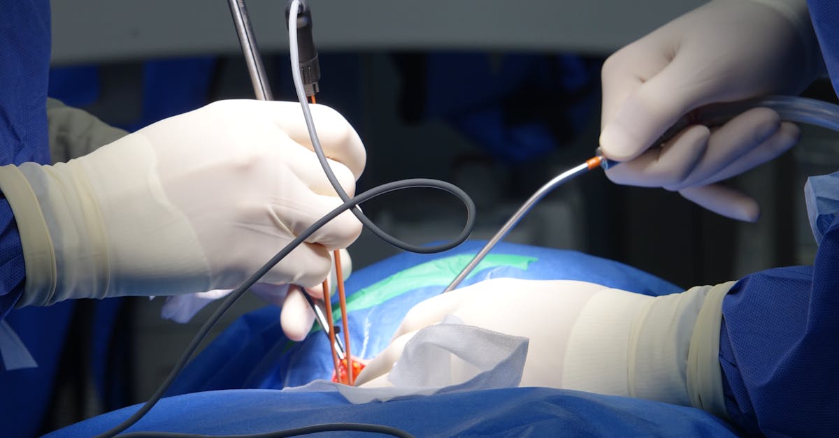 Sténose foraminale : le médecin généraliste au cœur du diagnostic
