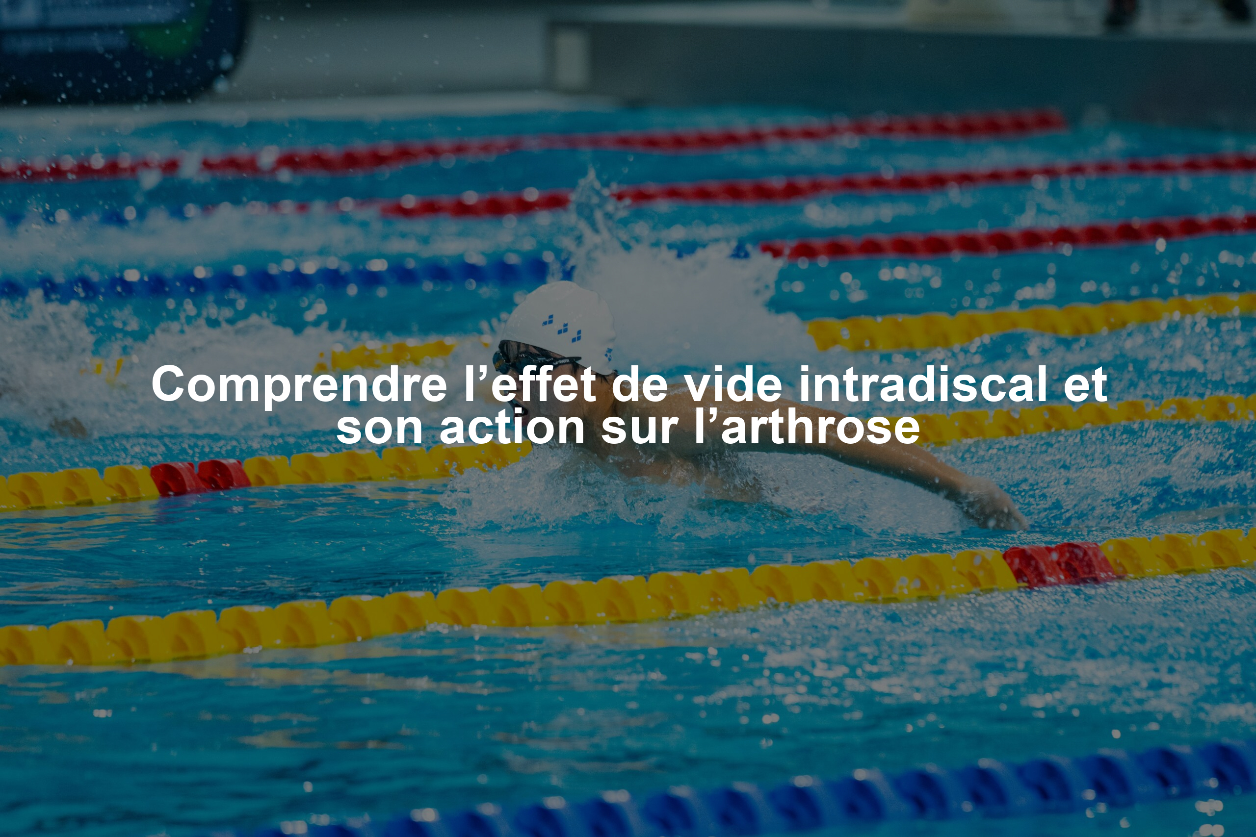 Comprendre l’effet de vide intradiscal et son action sur l’arthrose ...